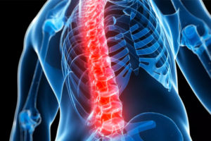 Neeld Family Chiropractic - Port St Lucie & Treasure Coast Chiropractor